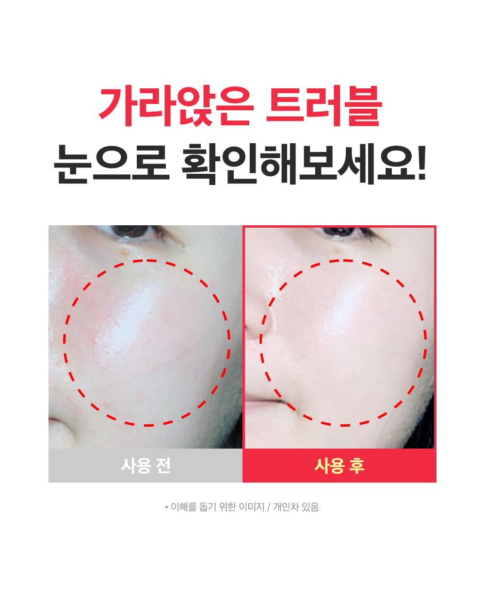 Shop SUNGBOON EDITOR - Red Heartleaf BHA-Lino Trouble Relief Cream ...