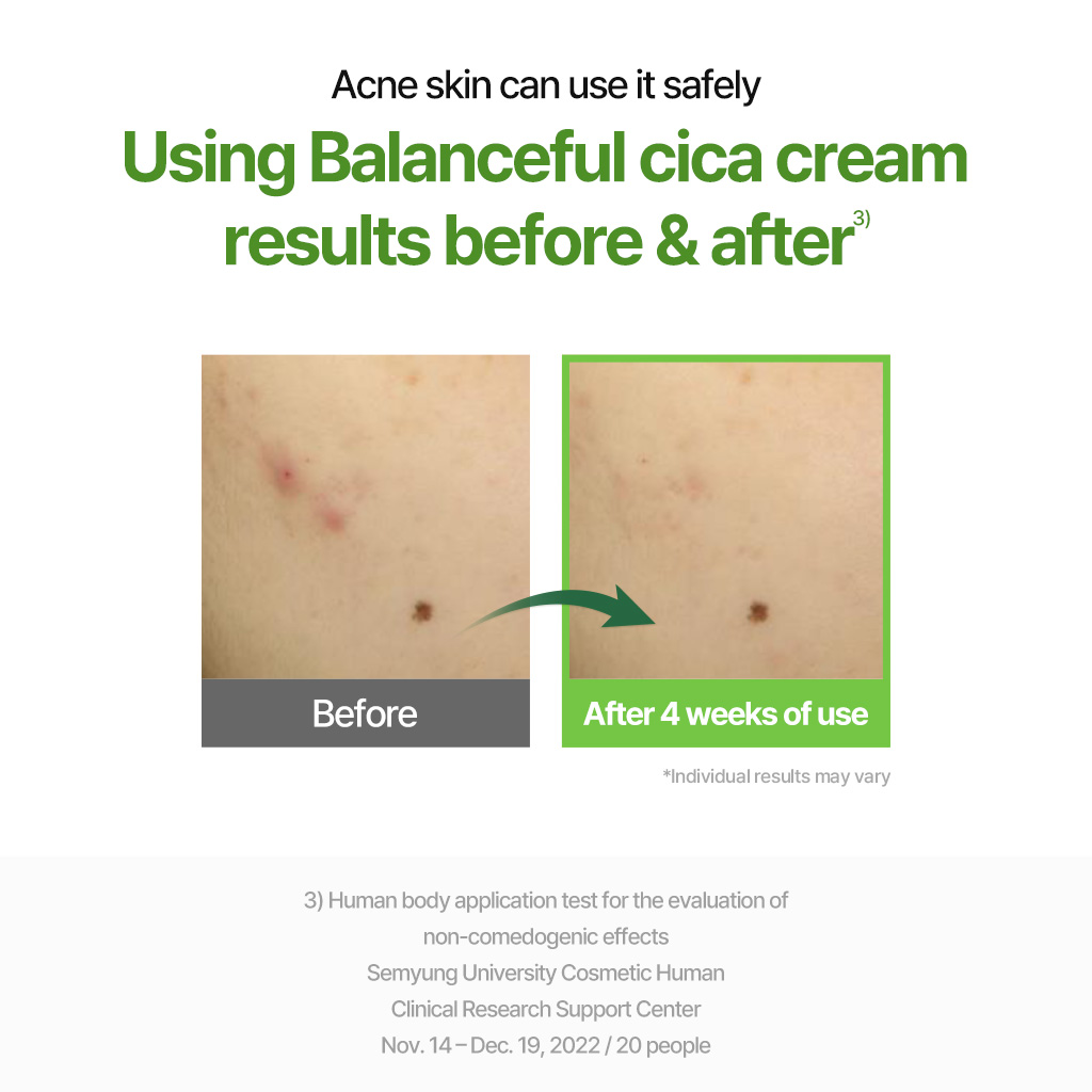 Shop Torriden - Balanceful Cica Cream - 80ml | Stylevana