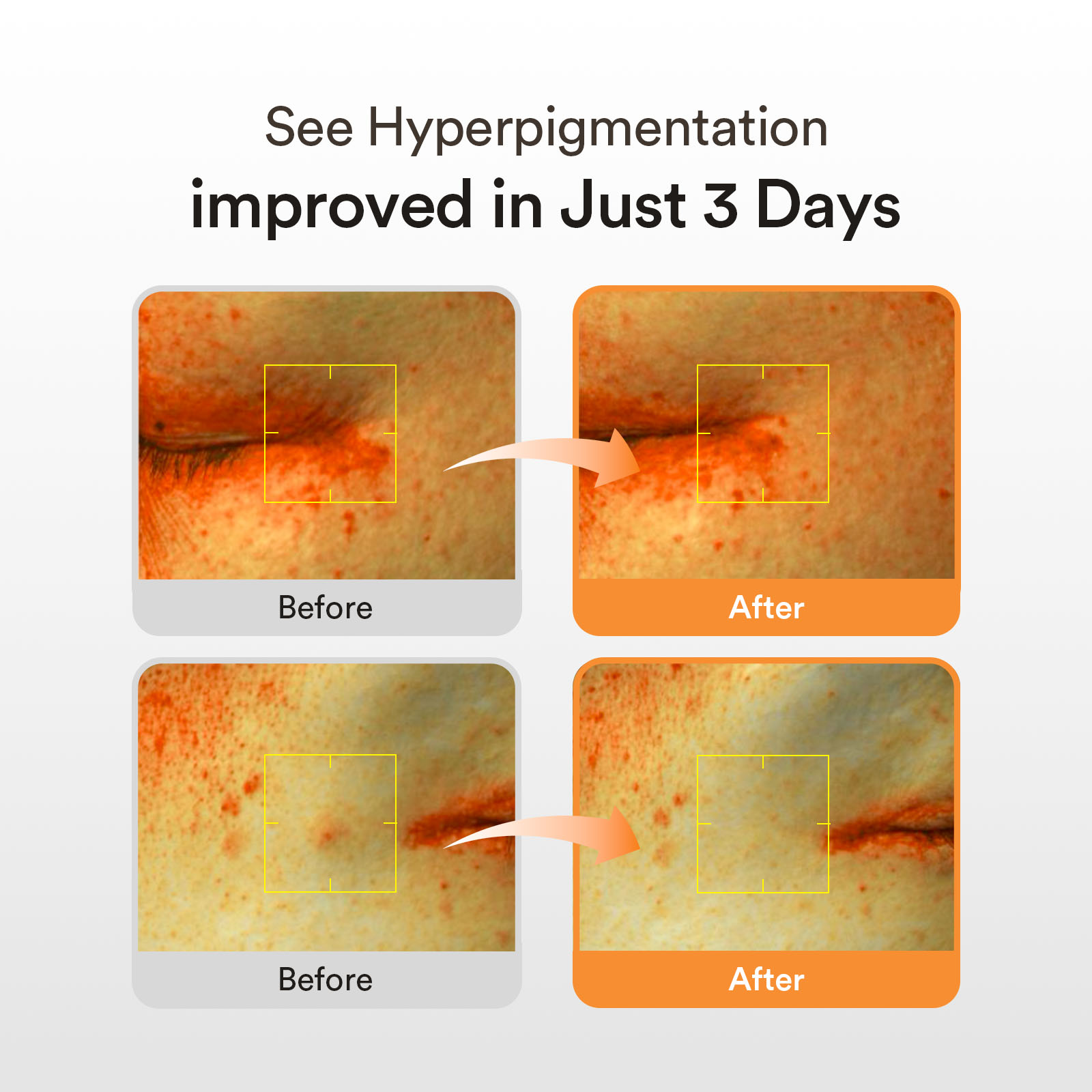 Shop Abib - Glutathiosome Dark Spot Serum Vita Drop - 50ml